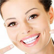 Lumident Veneers